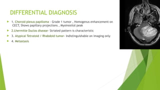 Neoplastic brain tumors in children.pptx
