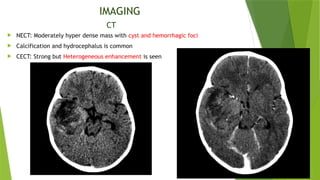Neoplastic brain tumors in children.pptx