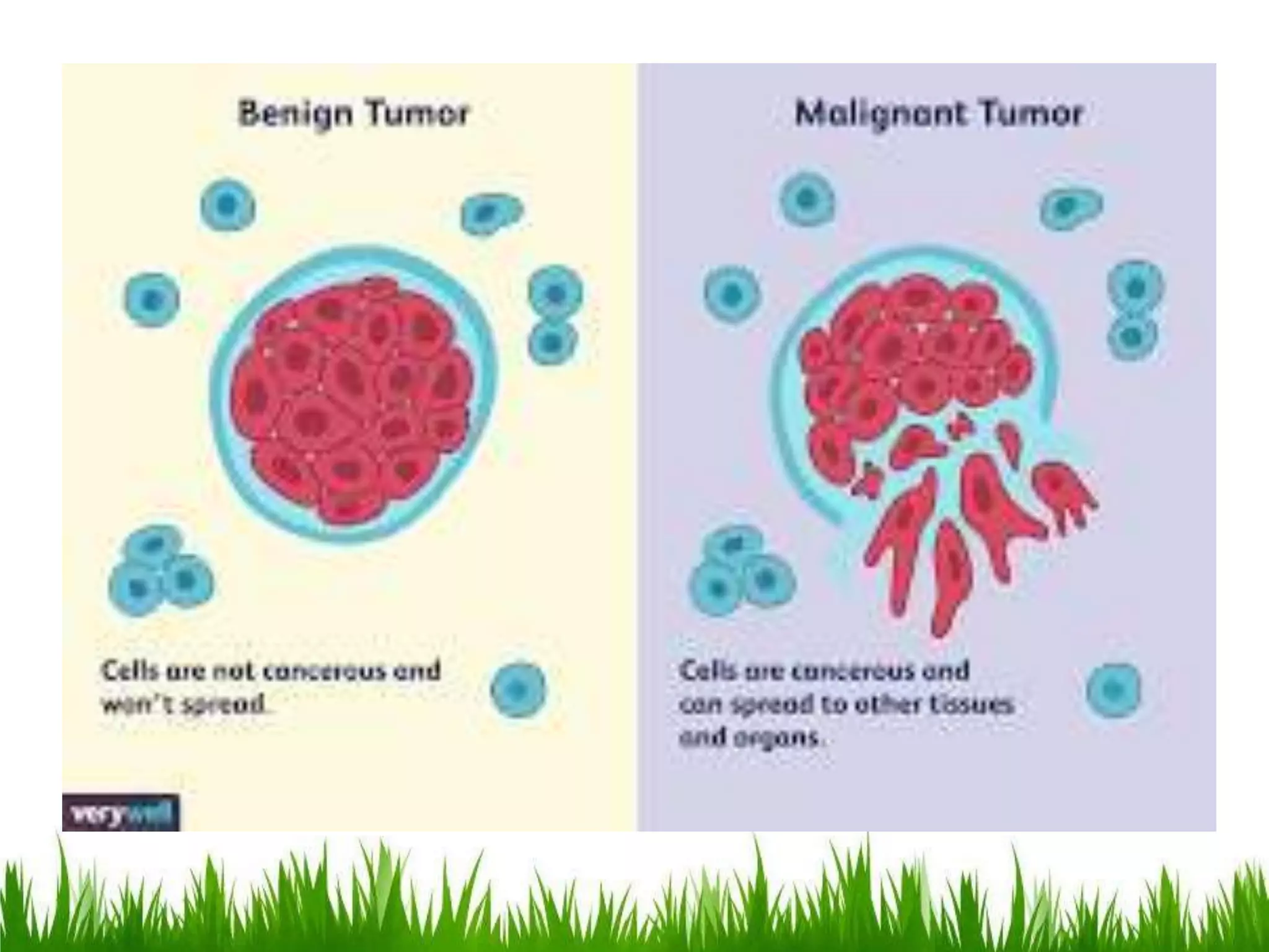 Neoplastic diseases | PPTX