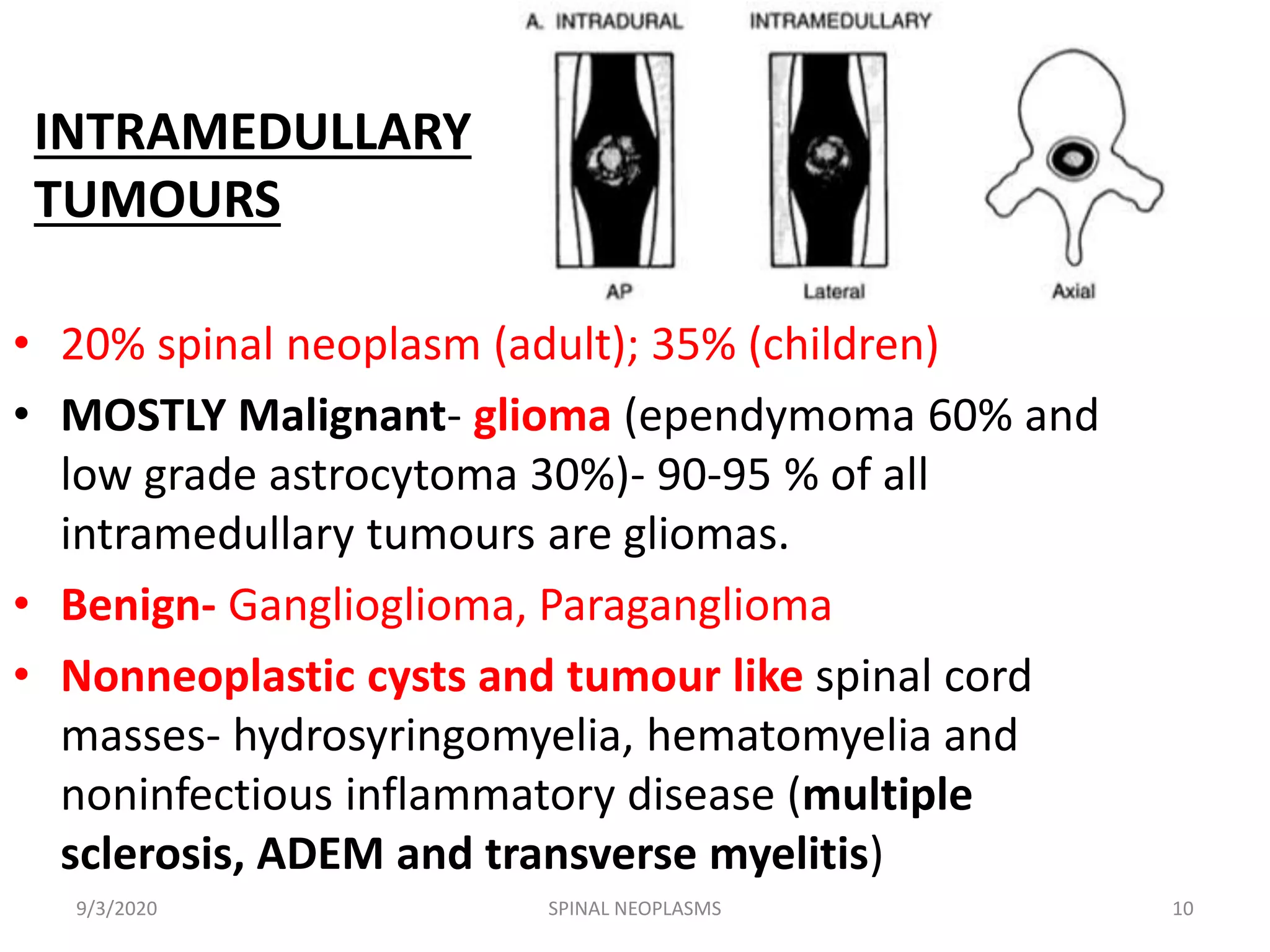 Neoplastic disorders of spinal cord | PPTX