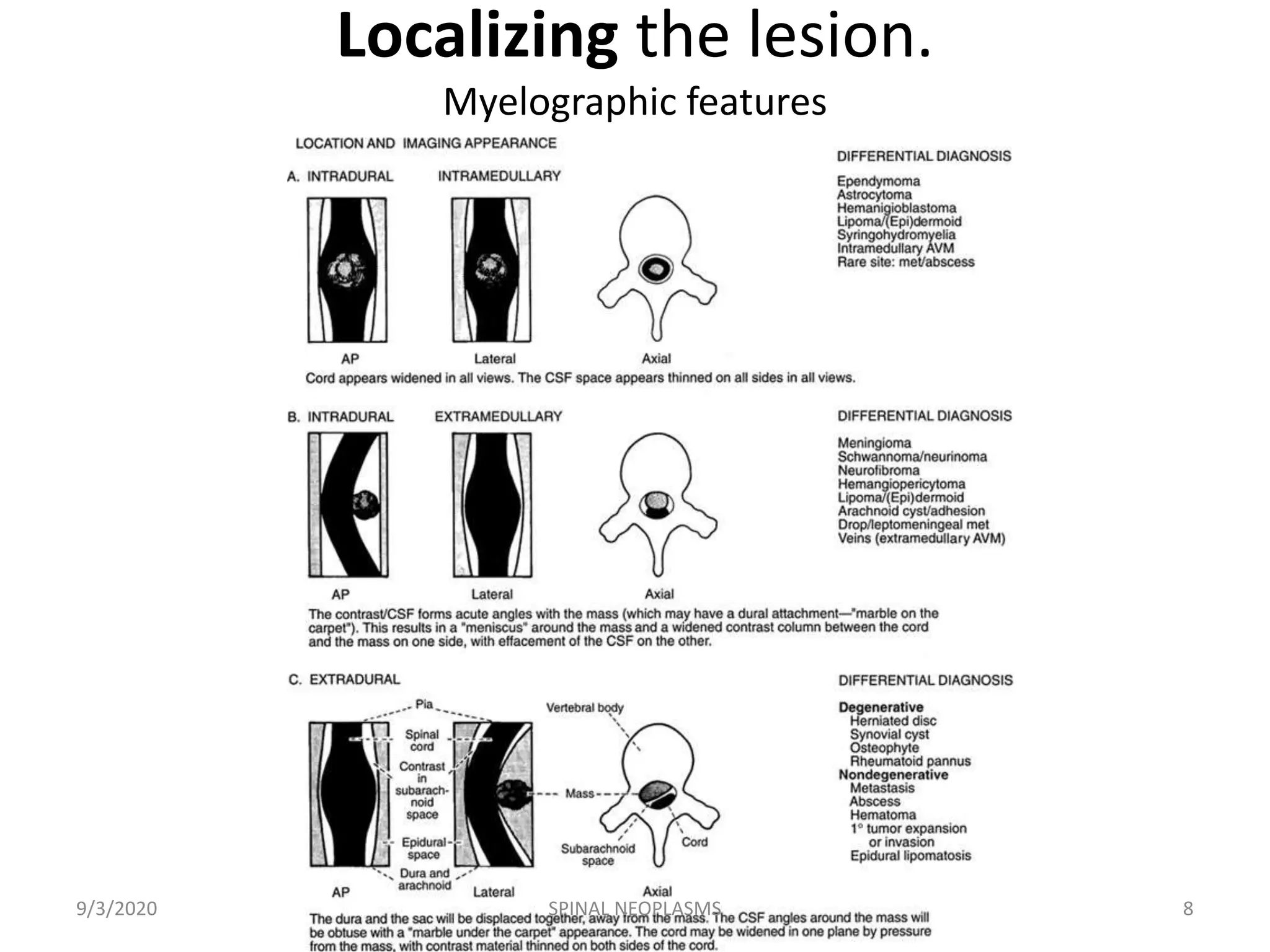 Neoplastic disorders of spinal cord | PPTX