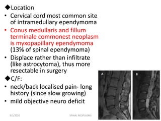 Neoplastic disorders of spinal cord | PPTX
