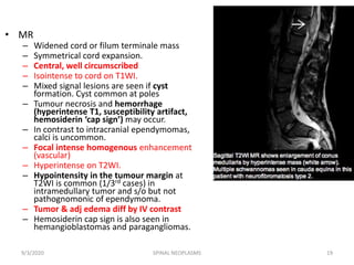 Neoplastic disorders of spinal cord | PPTX