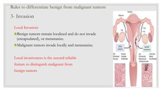 Neoplasia- cancer related presentation part2 | PPT
