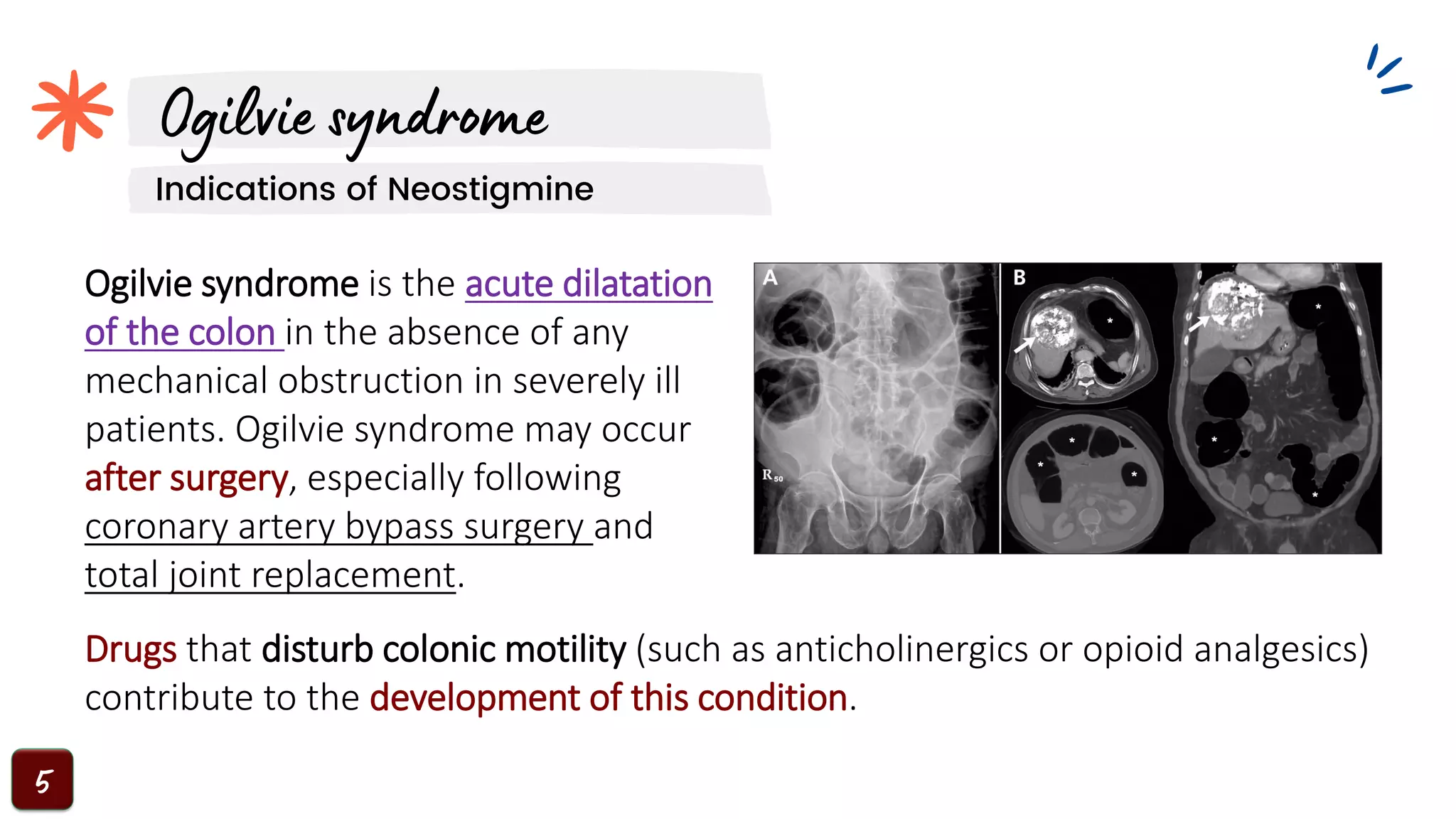 Neostigmine - Mechanism of action, indications and side effects | PDF