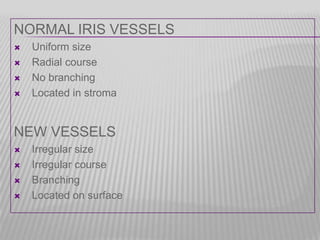 Neovascular glaucoma | PPTX
