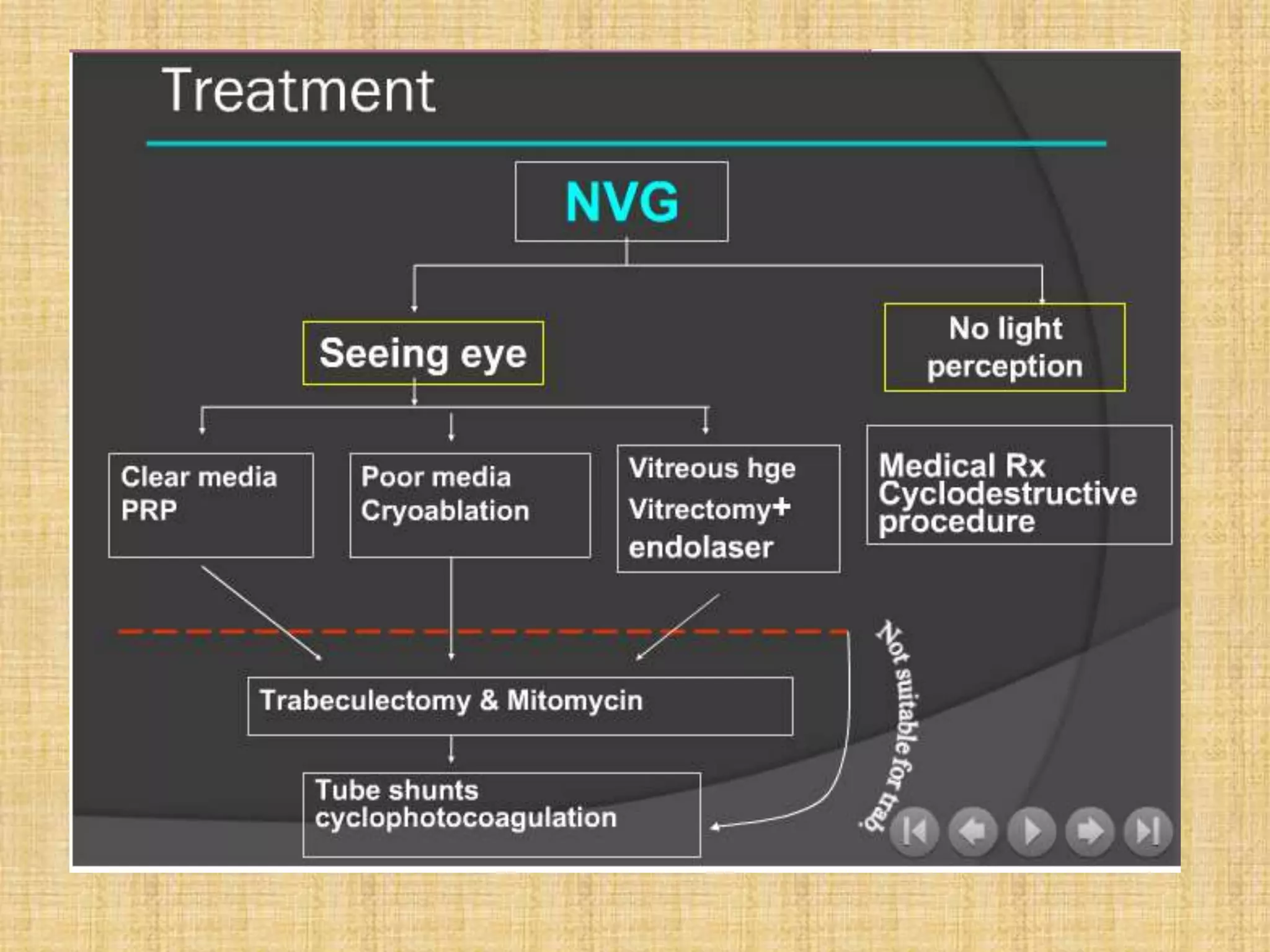 Neovascular glaucoma | PPTX