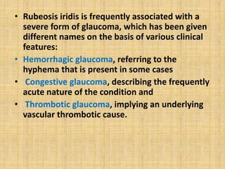 Neovascular glaucoma | PPTX