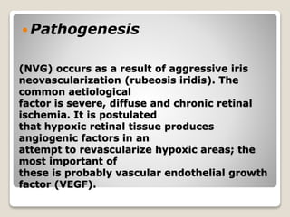 Neovascular glaucoma | PPSX