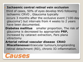 Neovascular glaucoma | PPSX