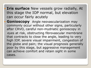 Neovascular glaucoma | PPT