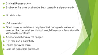 Neovascular glaucoma (NVG) | PPTX