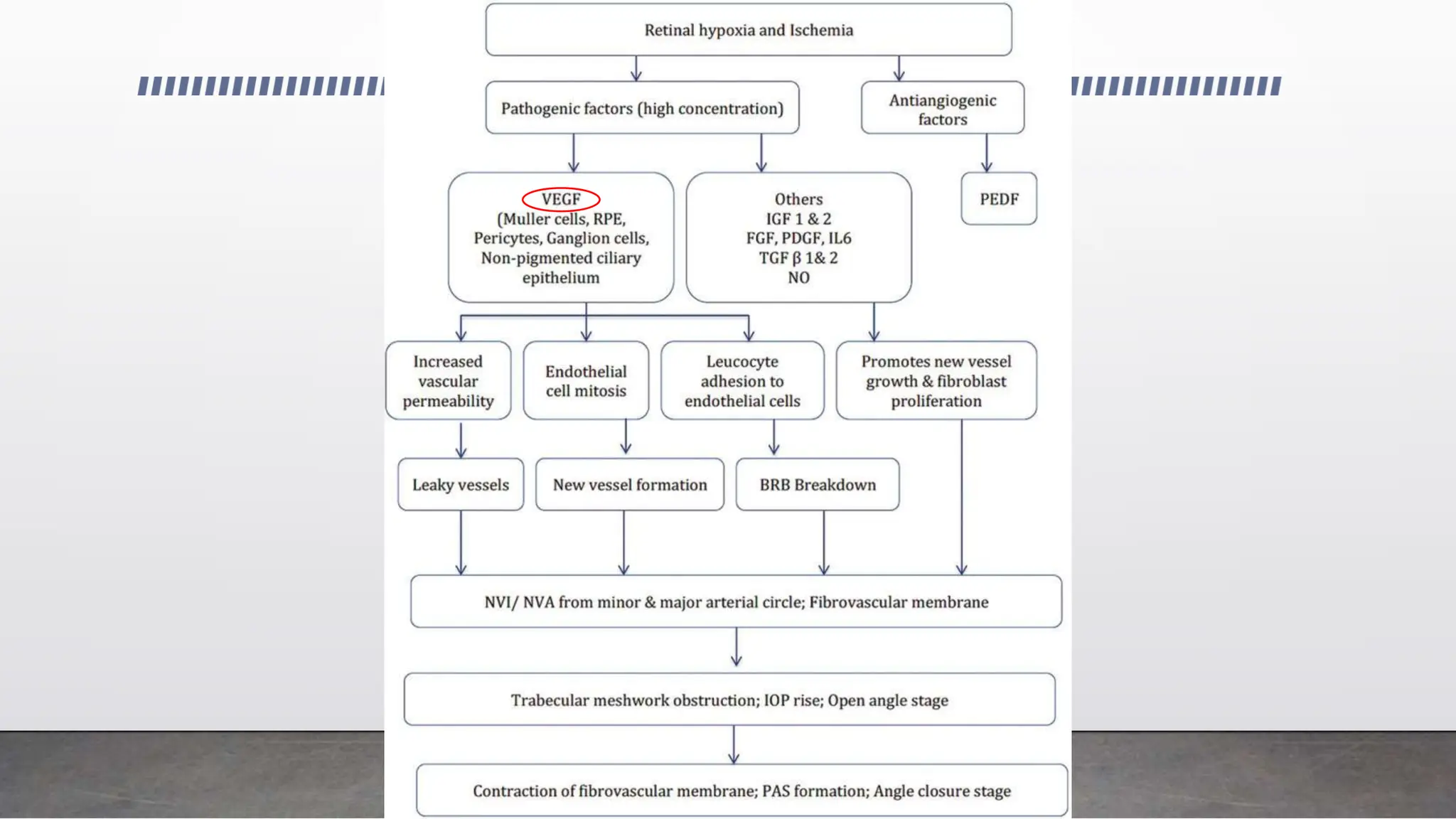 This is a case of neovascular glaucoma.pptx