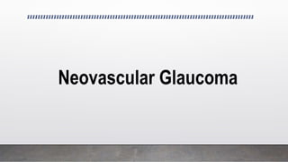 This is a case of neovascular glaucoma.pptx