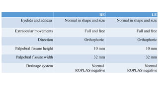 neovascular glaucoma.pptx..................... | PPTX