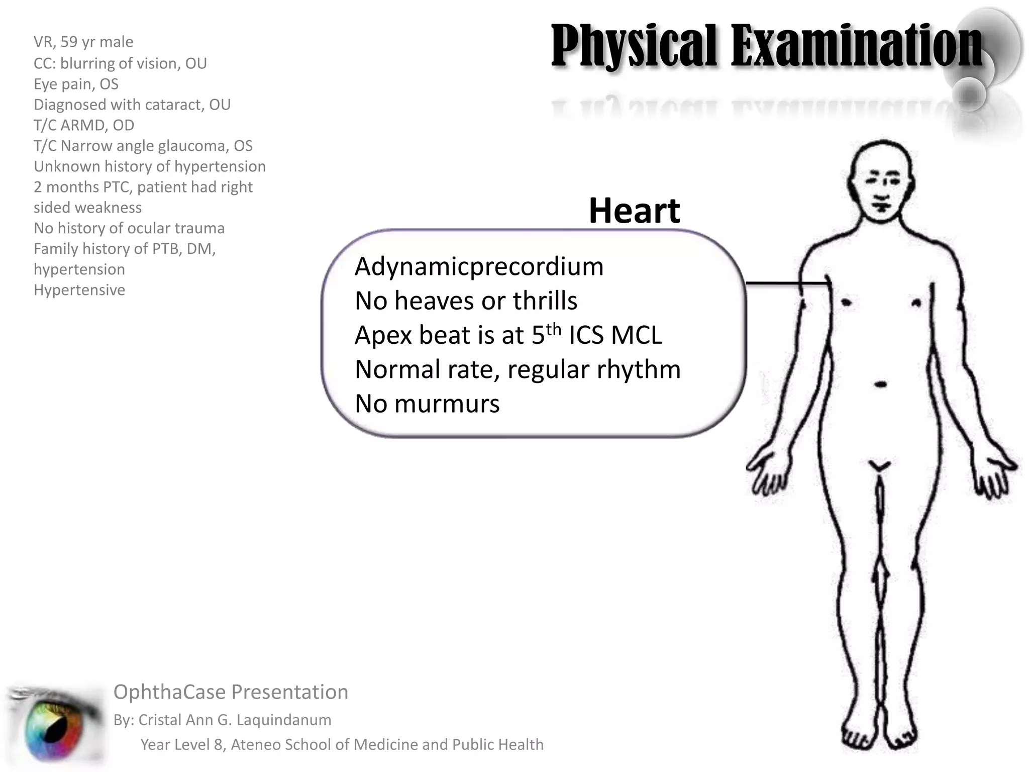 Neovascular glaucoma | PPTX | Eye and Vision Conditions | Diseases and ...