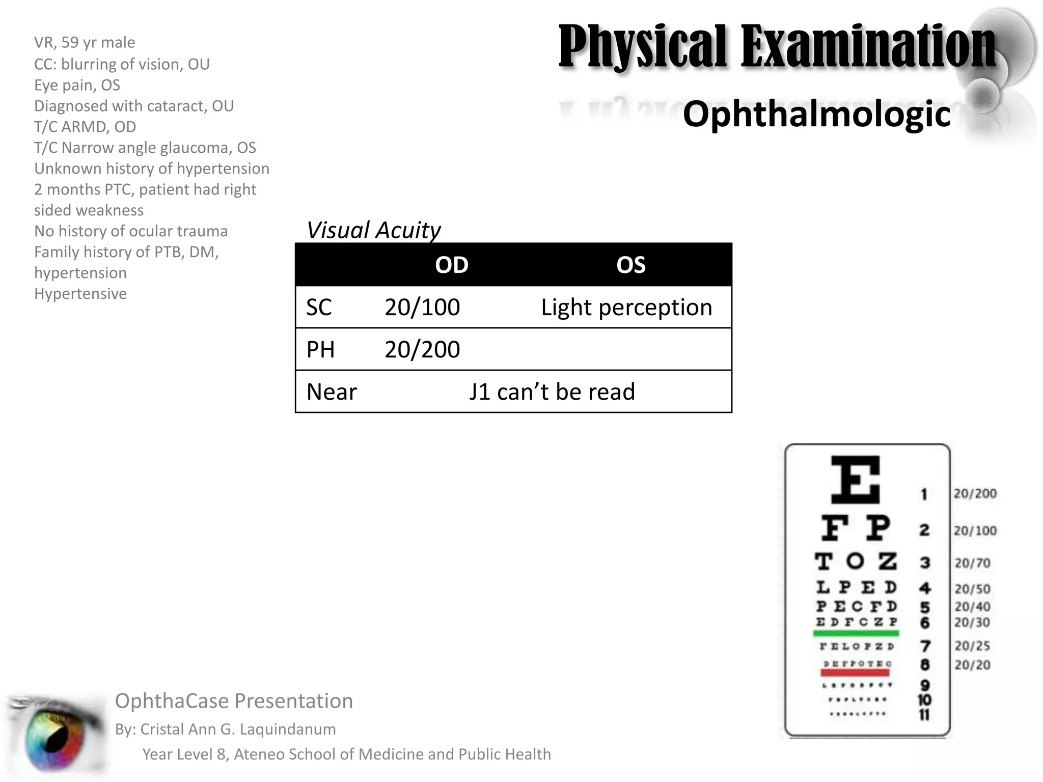 Neovascular glaucoma | PPTX | Eye and Vision Conditions | Diseases and Conditions