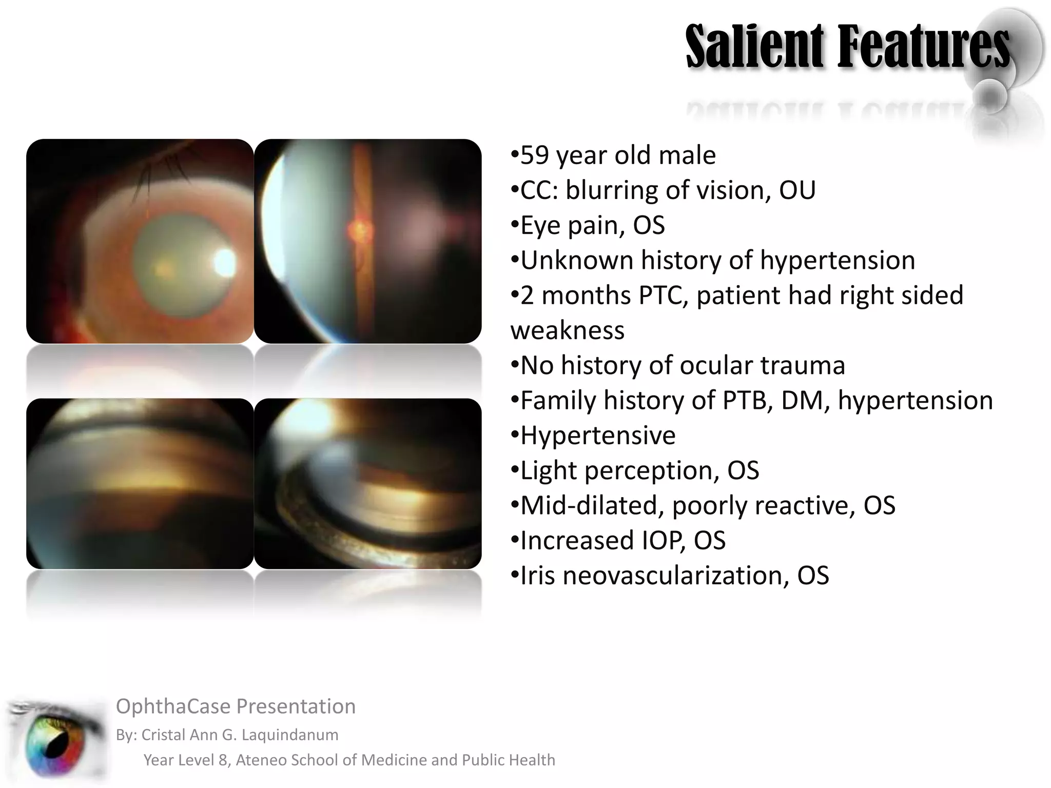 Neovascular glaucoma | PPTX | Eye and Vision Conditions | Diseases and Conditions