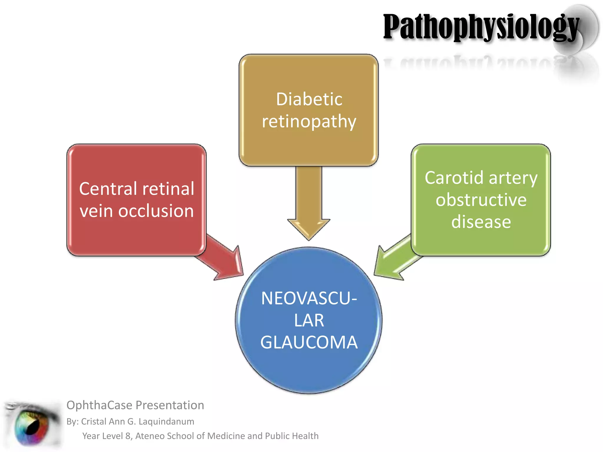 Neovascular glaucoma | PPTX | Eye and Vision Conditions | Diseases and ...