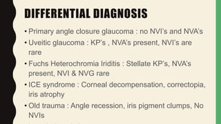 NeoVascular Glaucoma final.pptx