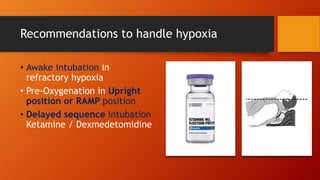 Difficult Airway in Polytrauma.pptx