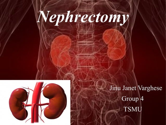 Nephrectomy | PPT | Surgery | Medical Health