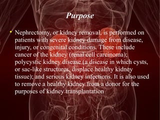 Nephrectomy | PPT