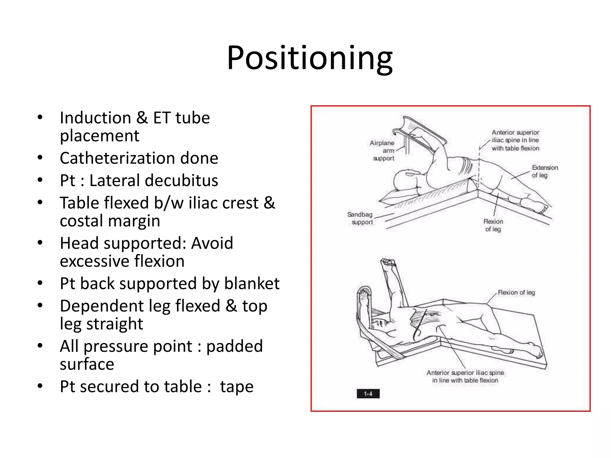 Nephrectomy : Operative Technique | PPTX