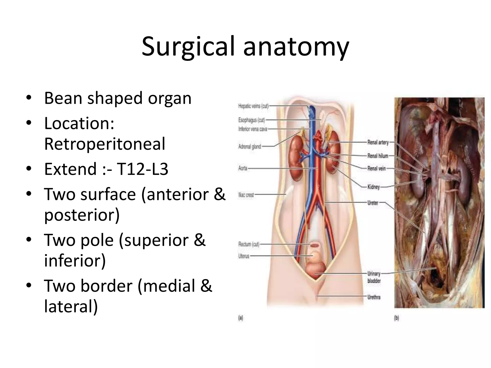 Nephrectomy : Operative Technique | PPTX