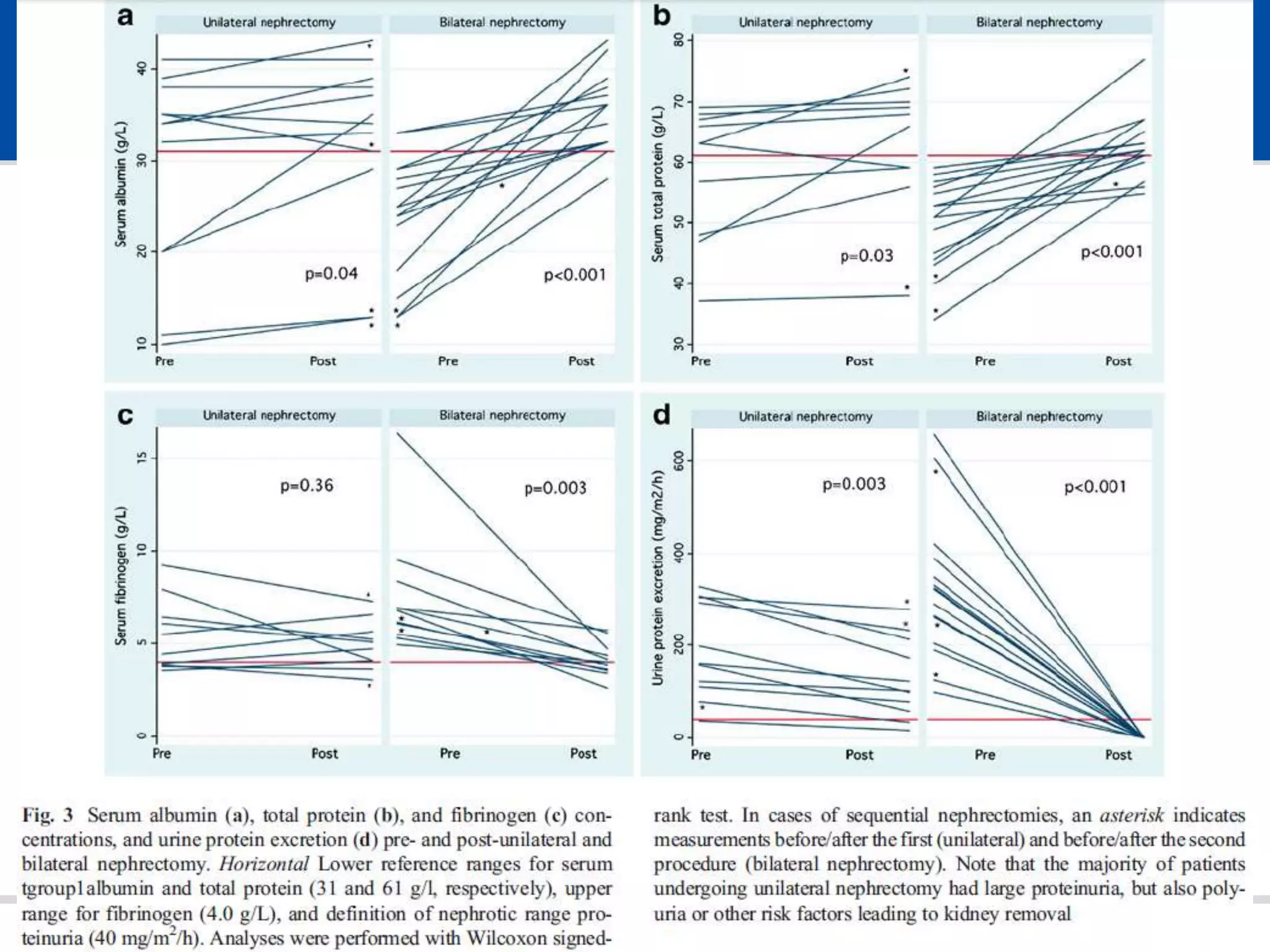 Journal Club. Native nephrectomy prior to pediatric kidney ...