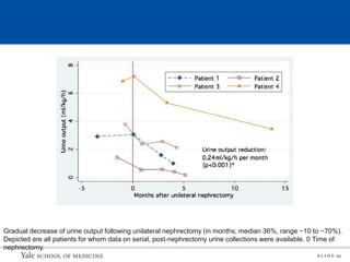 Journal Club. Native nephrectomy prior to pediatric kidney ...