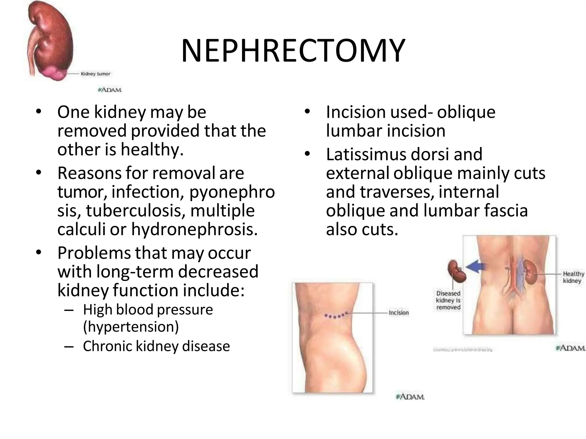 Nephrectomy PDF of human body and .pptx