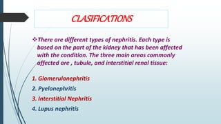 nephritis lecture for laboratory students -1.pptx