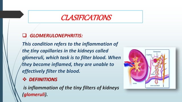 nephritis lecture for laboratory students -1.pptx