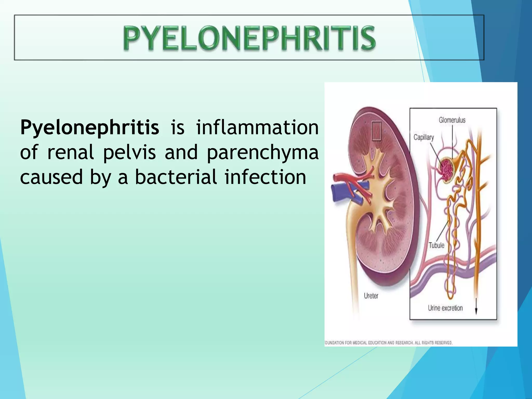 Nephritis | PPTX