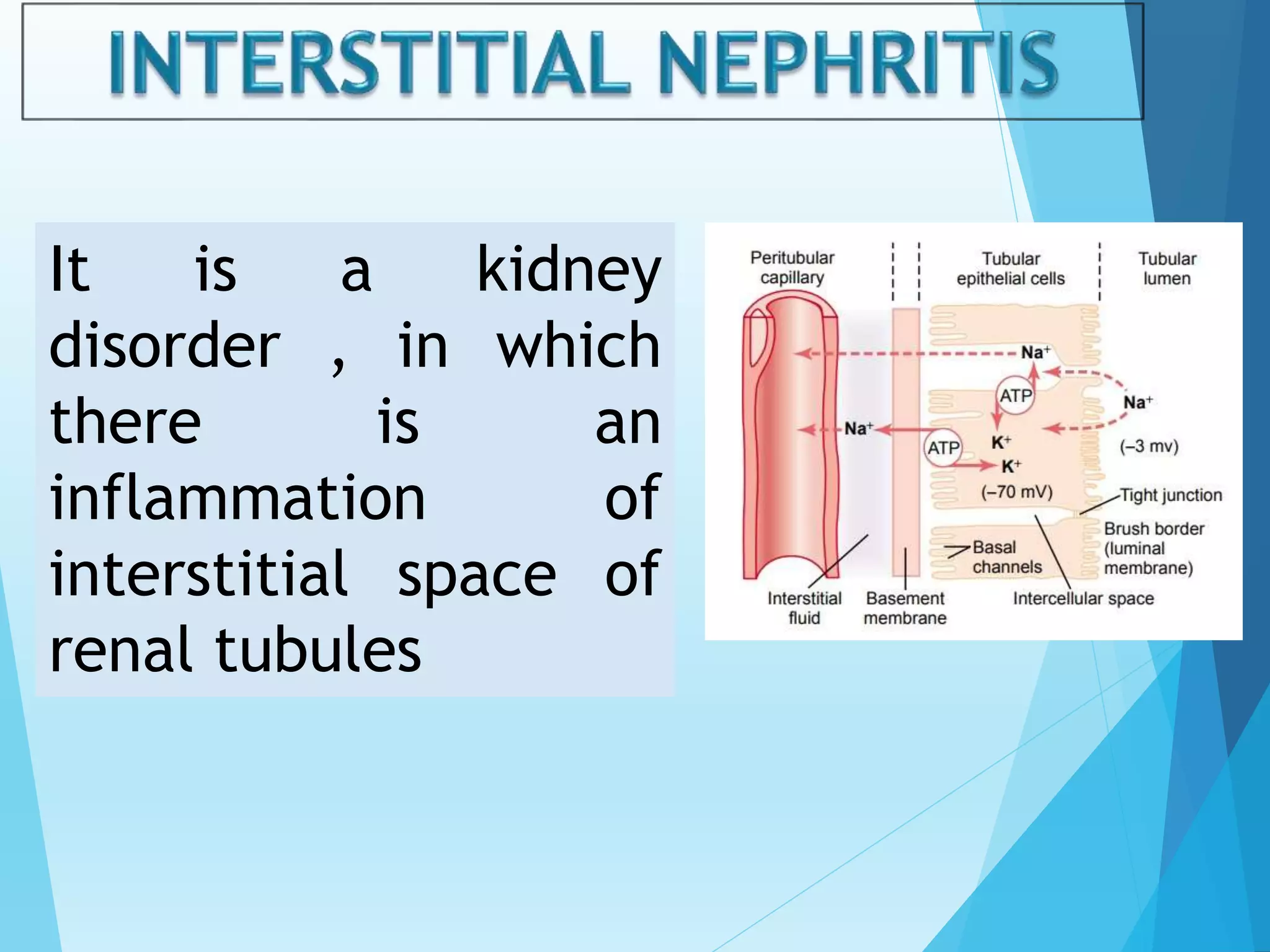 Nephritis | PPTX