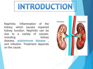 Nephritis | PPTX