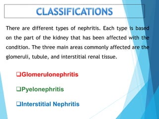 Nephritis | PPTX