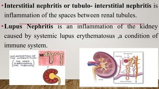 Nephritis.pptx