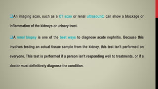Nephritis medical surgical nursing .pptx