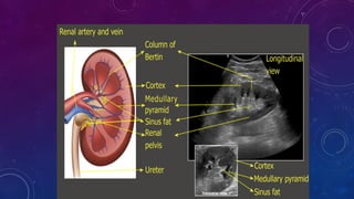 NEPHROBLASTOMA CASE PRESENTANTION.....pptx