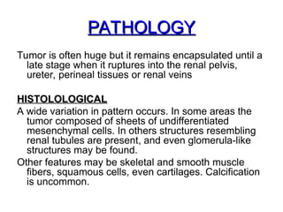 NEPHROBLASTOMA (WILMS’TUMOR)- DIAGNOSIS AND MANAGEMENT.ppt
