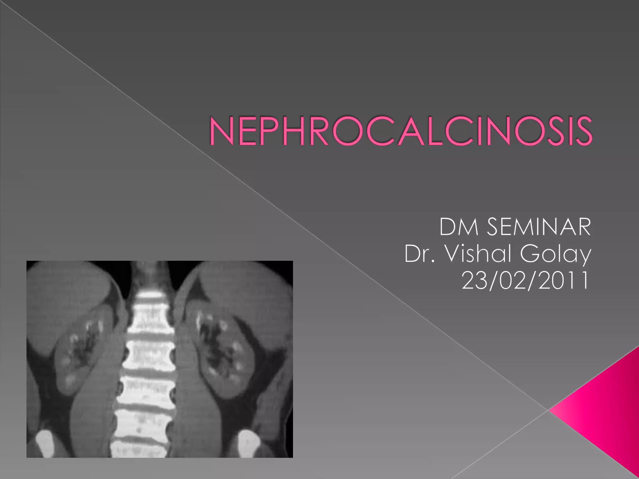 Nephrocalcinosis | PPTX