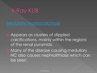 Nephrocalcinosis | PPTX