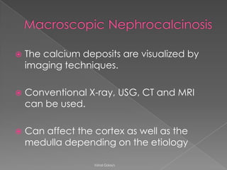 Nephrocalcinosis | PPTX