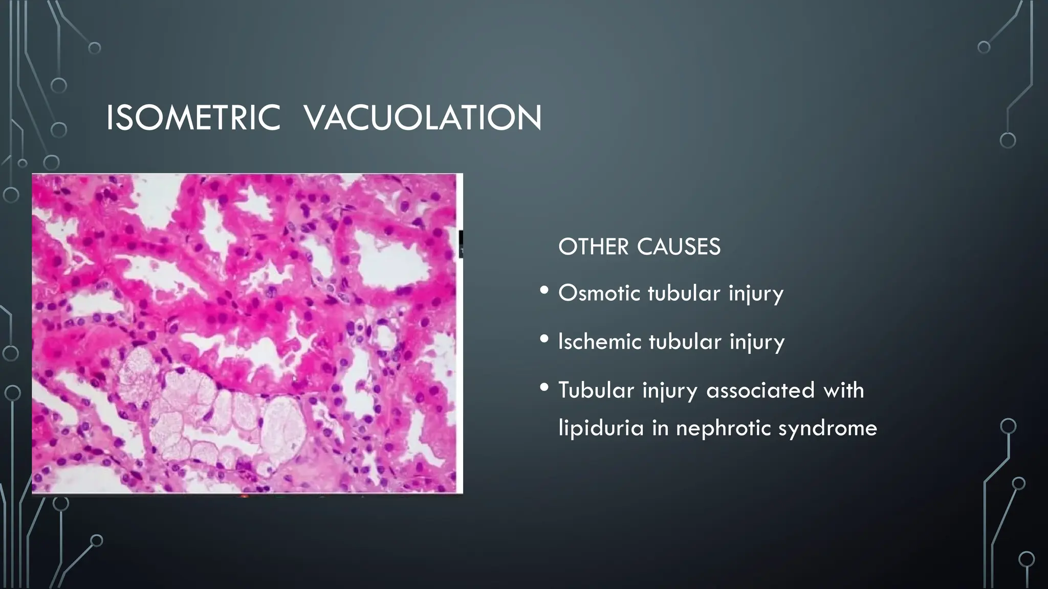 Nephrology department seminar- hyperkalemia.pptx | Digestive Disorders ...