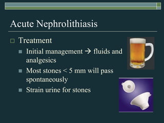 Nephrolithiasis | PPTX