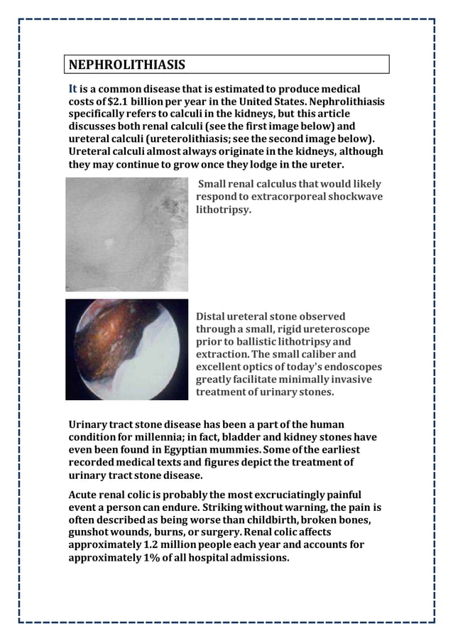 Nephrolithiasis | DOCX | Digestive Disorders | Diseases and Conditions