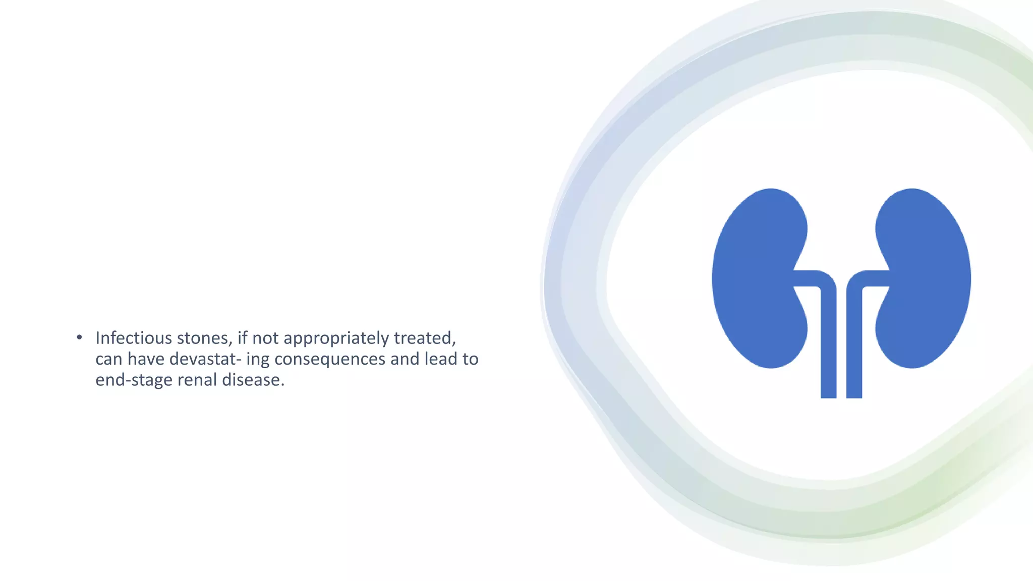 Nephrolithiasis_SHISODIA.pptx.pptx
