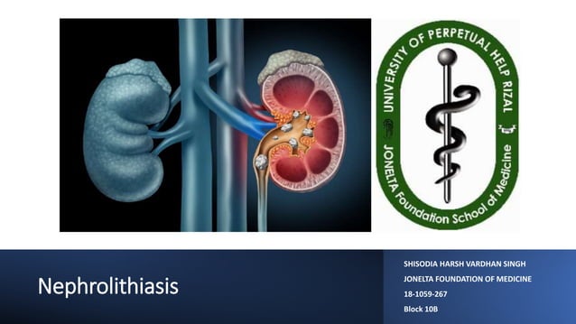 Nephrolithiasis_SHISODIA.pptx.pptx